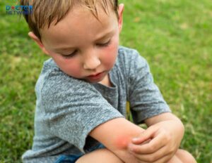 Are mouse bites dangerous? What to do when bitten by a mouse?