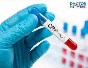 4 treatment methods for elevated CRP levels in children you should know!