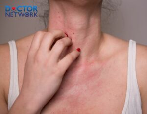 Red spots on the skin: 5 common causes and treatments