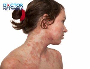 Red spots on the skin: 5 common causes and treatments