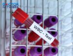 What is WBC in a blood test? 2 ways to assess the WBC index