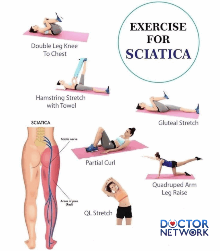 Can a Chiropractor Help With Sciatica? Expert Answers & Treatment Options - Doctor Network