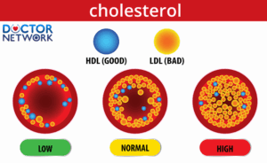Can High Cholesterol Cause Headaches? Exploring the Potential Link ...