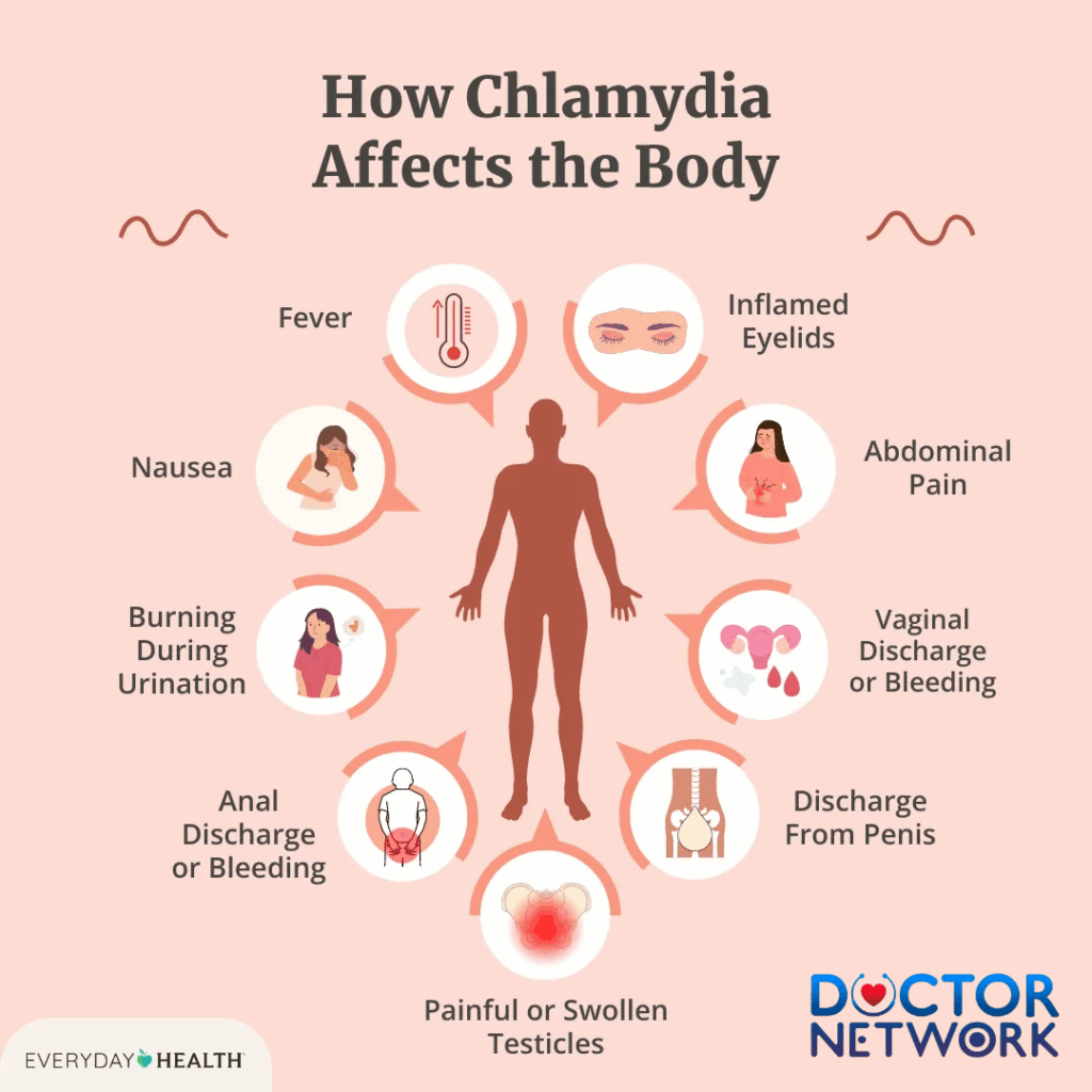 Can You Get Chlamydia From Kissing - Doctor Network
