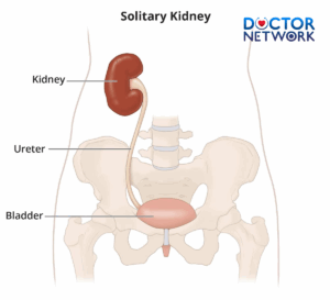 Can You Live With One Kidney: A Complete What You Need to Know - Doctor ...