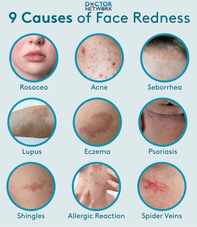 How to Get Rid of Redness on Face: Causes and Fast Relief Tips - Doctor ...